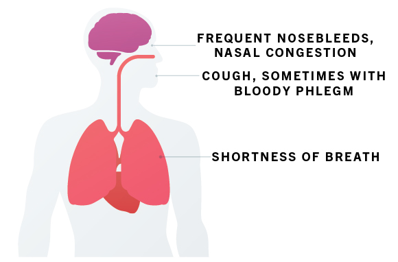 Genentech: Understanding GPA