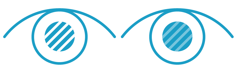 Genentech: UNDERSTANDING mCNV