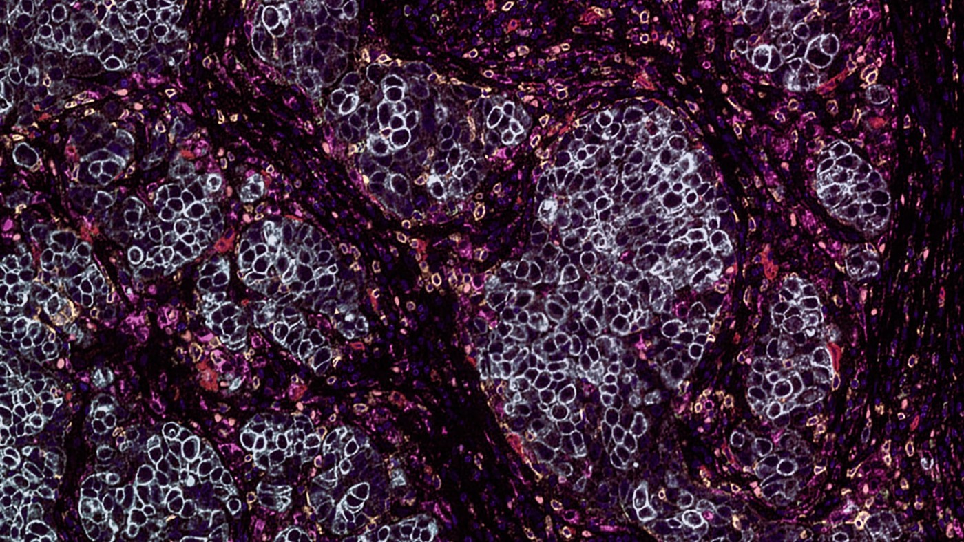 Genentech: The Space Between